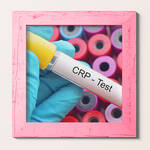 آزمایش CRP - وبلاگ شغلستون - جامع ترین شبکه اینترنتی کسب و کار